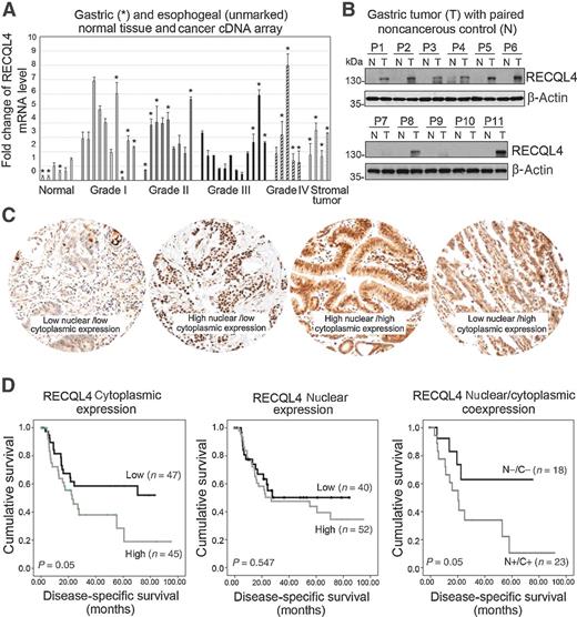 Human Helicase RECQL4 Drives Cisplatin Resistance in Gastric Cancer by ...