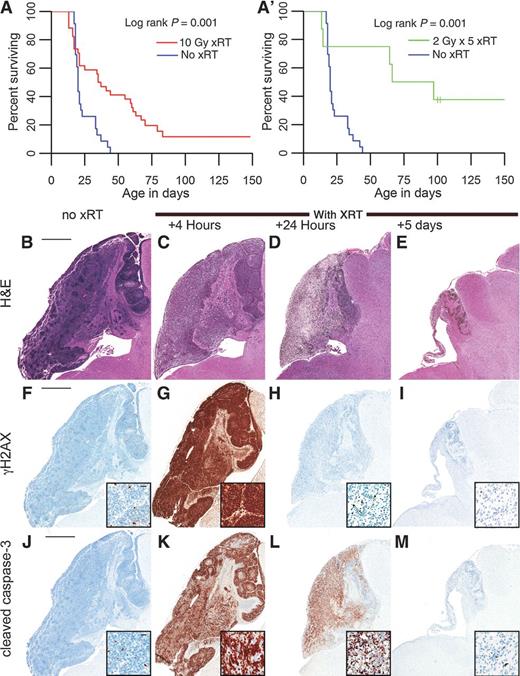 Radiation Sensitivity in a Preclinical Mouse Model of Medulloblastoma ...