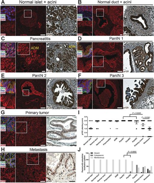 p120 Catenin Suppresses Basal Epithelial Cell Extrusion in Invasive ...