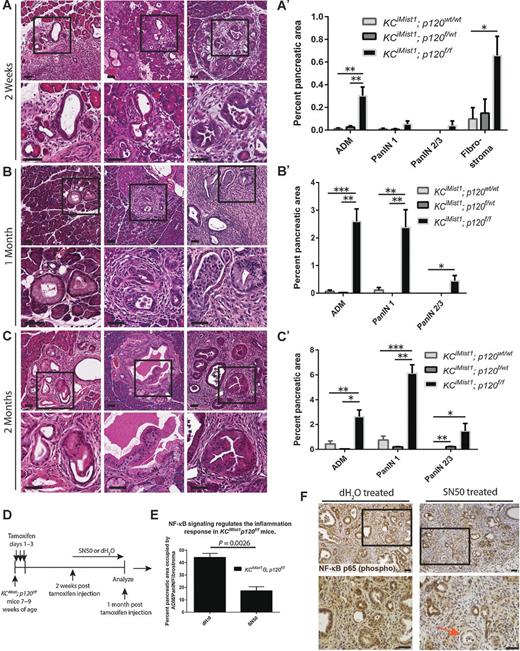 p120 Catenin Suppresses Basal Epithelial Cell Extrusion in Invasive ...