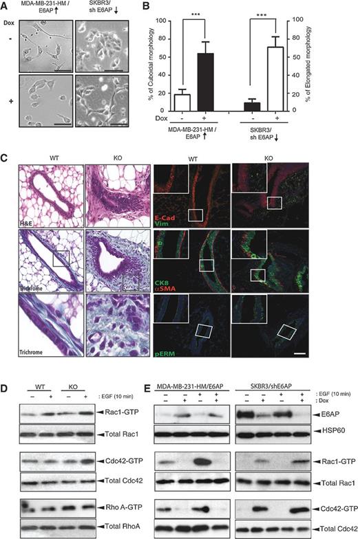 The E3-ligase E6AP Represses Breast Cancer Metastasis via Regulation of ...