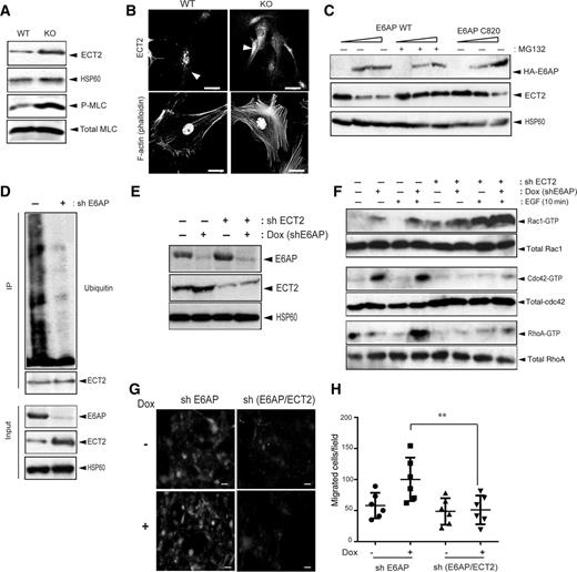The E3-ligase E6AP Represses Breast Cancer Metastasis via Regulation of ...