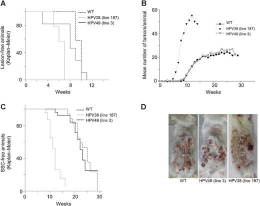 Novel ß-HPV49 Transgenic Mouse Model of Upper Digestive Tract Cancer ...