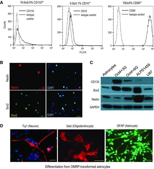 Rapid Reprogramming of Primary Human Astrocytes into Potent Tumor ...