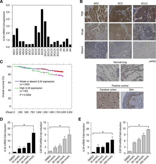 Chemotherapy-Induced IL34 Enhances Immunosuppression by Tumor ...