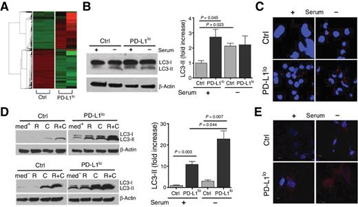 Tumor Intrinsic Pd L1 Signals Regulate Cell Growth Pathogenesis And