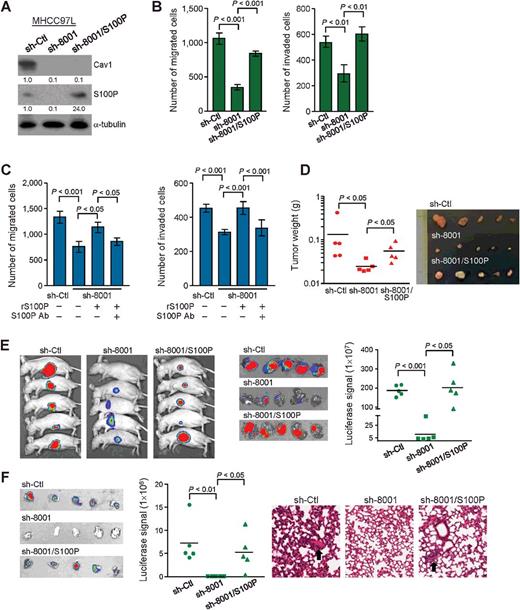 Mechanisms through Which Hypoxia-Induced Caveolin-1 Drives ...