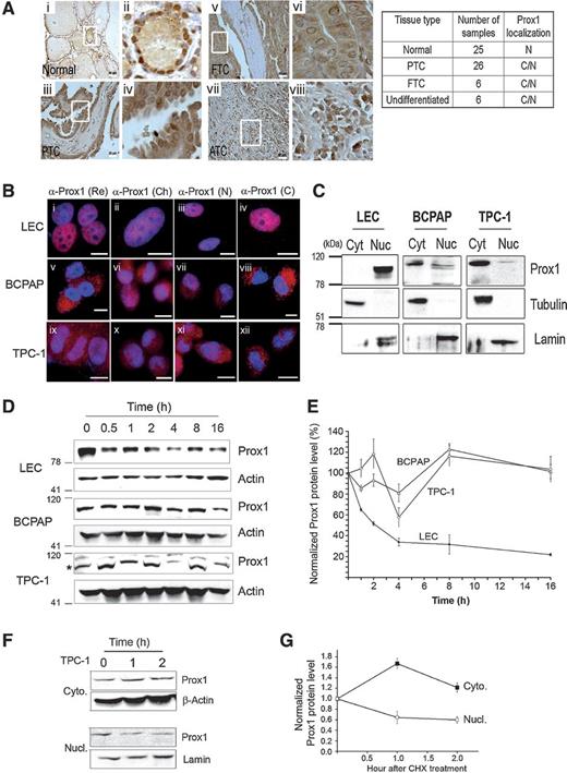 Aberrant Activation of Notch Signaling Inhibits PROX1 Activity to ...