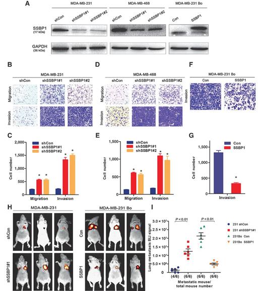 SSBP1 Suppresses TGFβ-Driven Epithelial-to-Mesenchymal Transition and ...