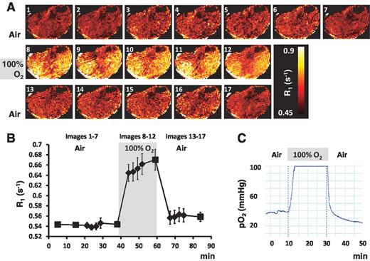 Oxygen-Enhanced MRI Accurately Identifies, Quantifies, and Maps Tumor ...