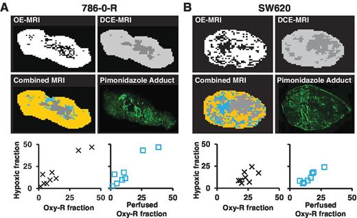 Oxygen-Enhanced MRI Accurately Identifies, Quantifies, and Maps Tumor ...