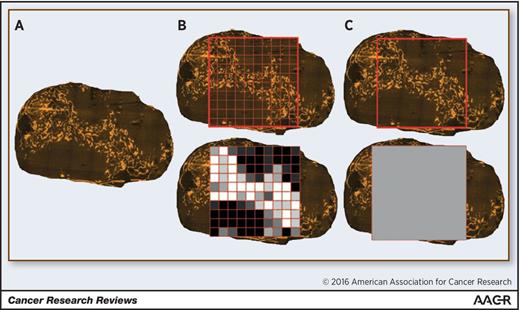Oxygen-Enhanced MRI Is a Major Advance in Tumor Hypoxia Imaging ...