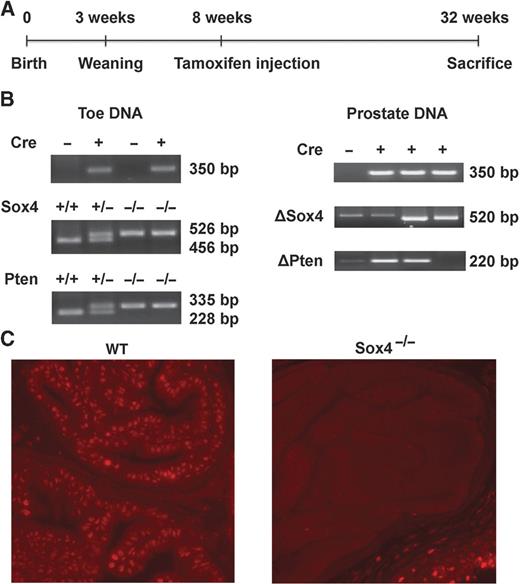 SOX4 Is Essential for Prostate Tumorigenesis Initiated by PTEN Ablation ...
