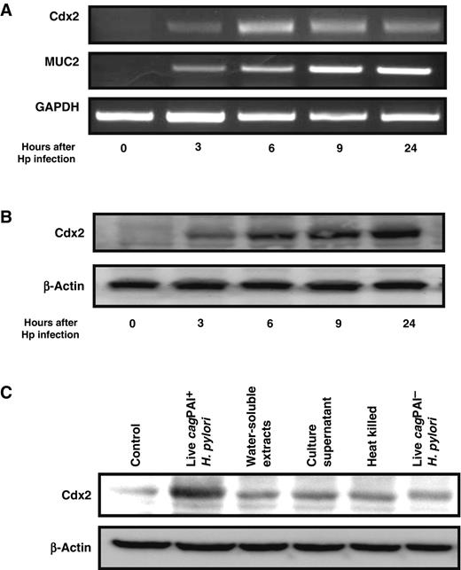 Cdx2 Expression and Intestinal Metaplasia Induced by H. pylori ...
