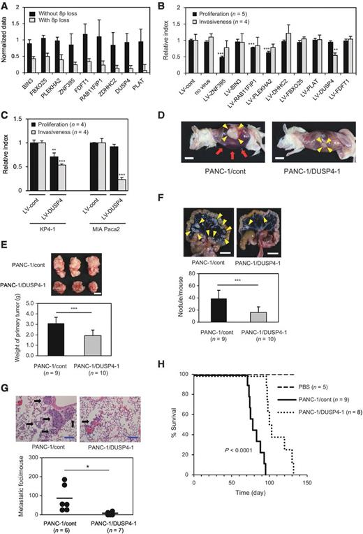 Genomic Loss of DUSP4 Contributes to the Progression of Intraepithelial ...