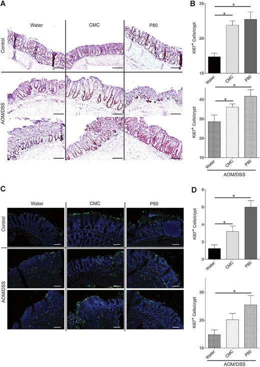 Dietary Emulsifier–Induced Low-Grade Inflammation Promotes Colon ...