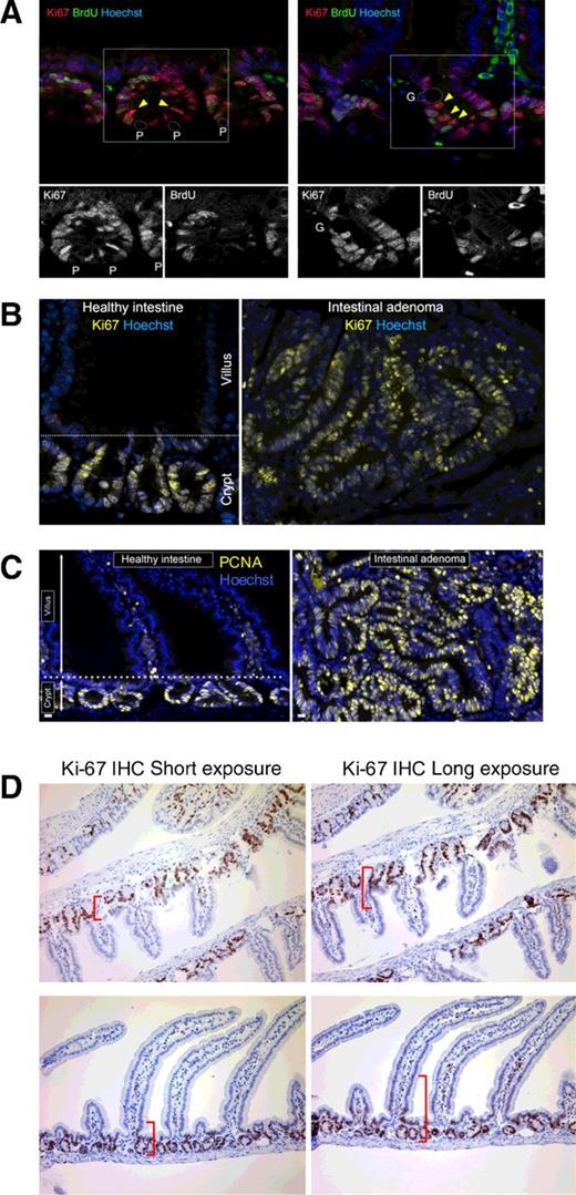 Cell-Cycle Regulation Accounts for Variability in Ki-67 Expression ...