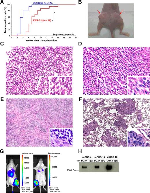 CIC-DUX4 Induces Small Round Cell Sarcomas Distinct from Ewing Sarcoma ...