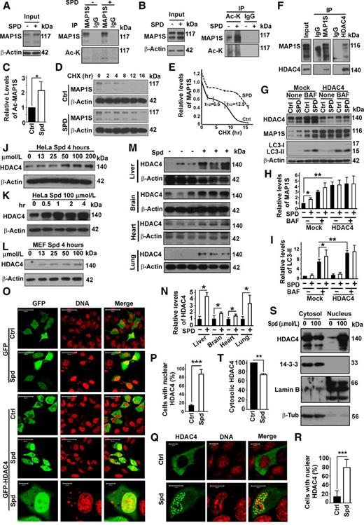Spermidine Prolongs Lifespan and Prevents Liver Fibrosis and ...