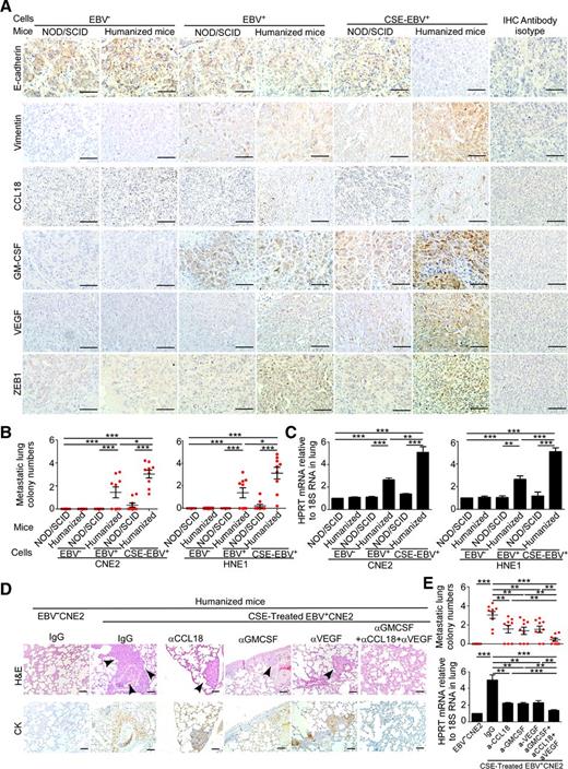Epstein–Barr Virus-Induced VEGF and GM-CSF Drive Nasopharyngeal ...