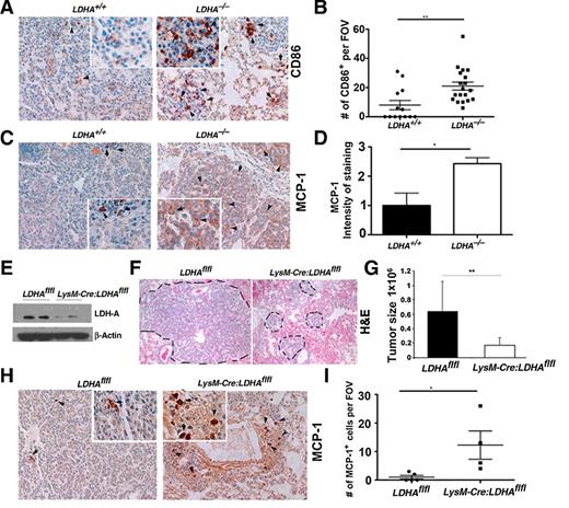 Deletion of Lactate Dehydrogenase-A in Myeloid Cells Triggers Antitumor ...