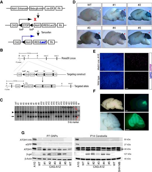 ATOH1 Promotes Leptomeningeal Dissemination and Metastasis of Sonic ...