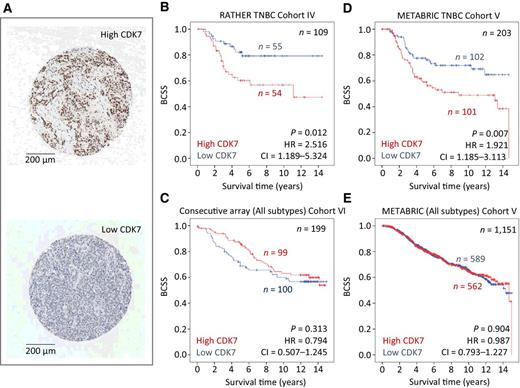 Therapeutic Rationale to Target Highly Expressed CDK7 Conferring Poor ...