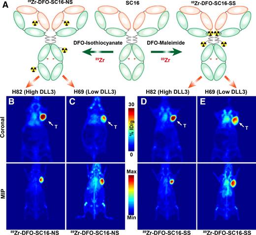 Noninvasive Interrogation of DLL3 Expression in Metastatic Small Cell ...