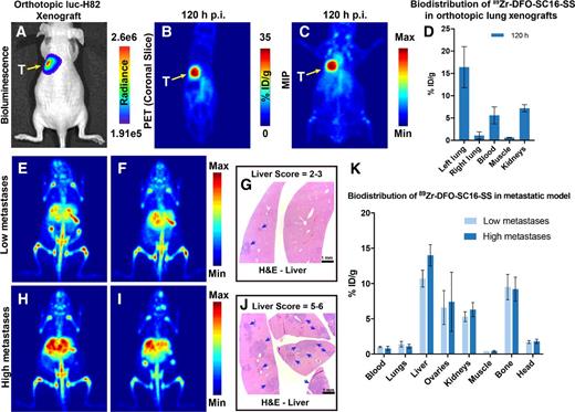 Noninvasive Interrogation of DLL3 Expression in Metastatic Small Cell ...