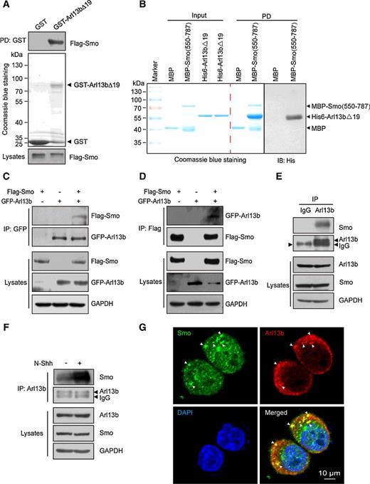 Arl13b Promotes Gastric Tumorigenesis by Regulating Smo Trafficking and ...