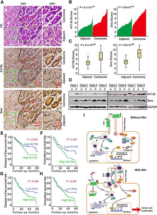 Arl13b Promotes Gastric Tumorigenesis by Regulating Smo Trafficking and ...