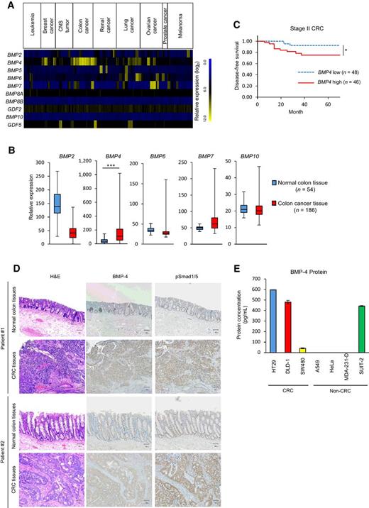 Autocrine BMP-4 Signaling Is a Therapeutic Target in Colorectal Cancer ...