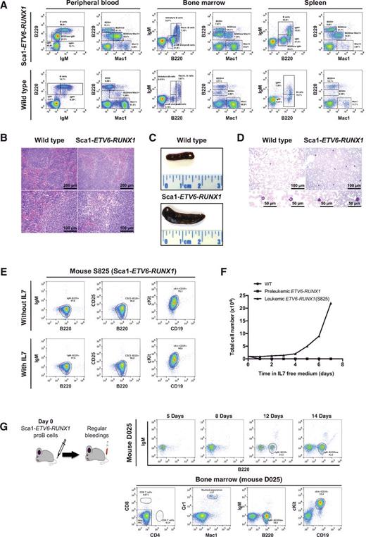 Infection Exposure Promotes ETV6-RUNX1 Precursor B-cell Leukemia via ...