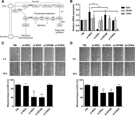 Glycerol-3-phosphate Acyltransferase 1 Promotes Tumor Cell Migration ...