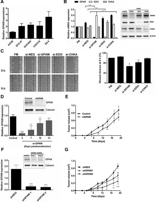 Glycerol-3-phosphate Acyltransferase 1 Promotes Tumor Cell Migration ...