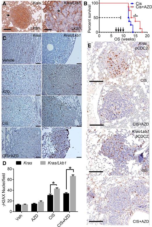 WEE1 Kinase Inhibitor AZD1775 Has Preclinical Efficacy in LKB1 ...