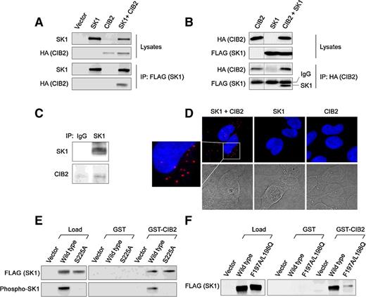 CIB2 Negatively Regulates Oncogenic Signaling in Ovarian Cancer via ...