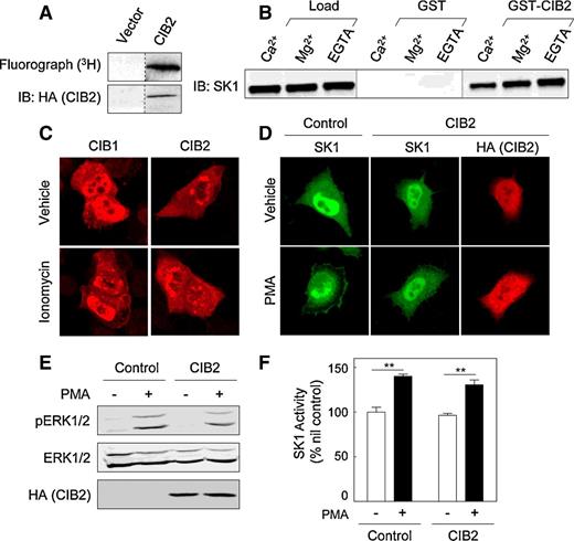 CIB2 Negatively Regulates Oncogenic Signaling in Ovarian Cancer via ...