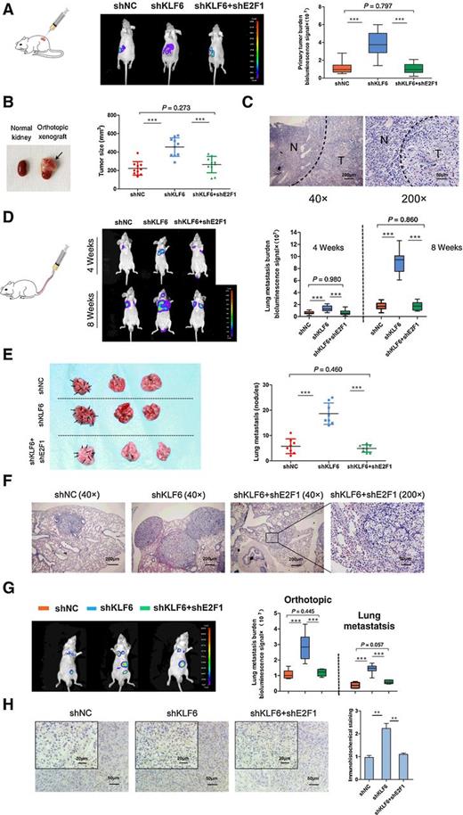 KLF6 Suppresses Metastasis of Clear Cell Renal Cell Carcinoma via ...