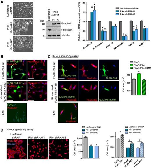 Plk4 Promotes Cancer Invasion and Metastasis through Arp2/3 Complex ...