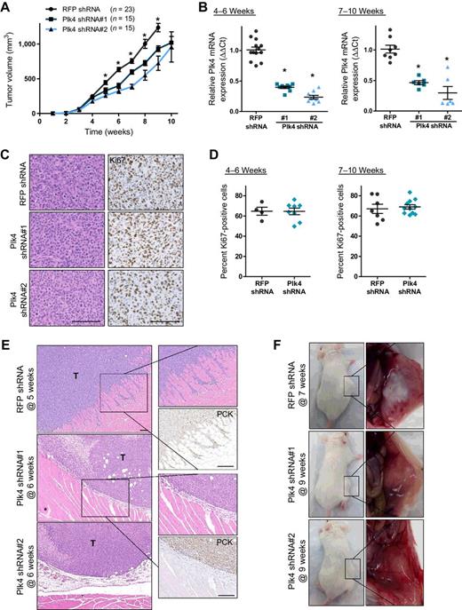 Plk4 Promotes Cancer Invasion and Metastasis through Arp2/3 Complex ...