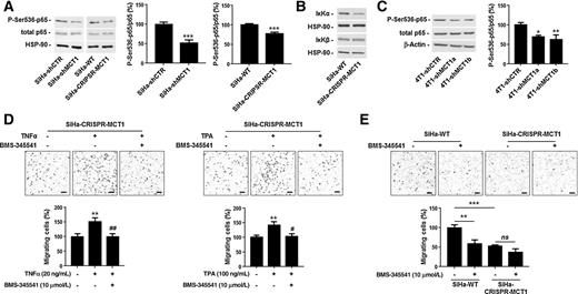 Monocarboxylate Transporter MCT1 Promotes Tumor Metastasis ...