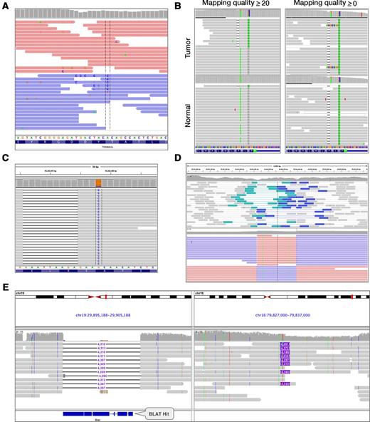 Variant Review with the Integrative Genomics Viewer | Cancer Research ...