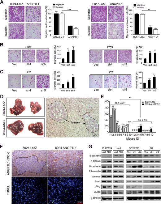 ANGPTL1 Interacts with Integrin α1β1 to Suppress HCC Angiogenesis and ...