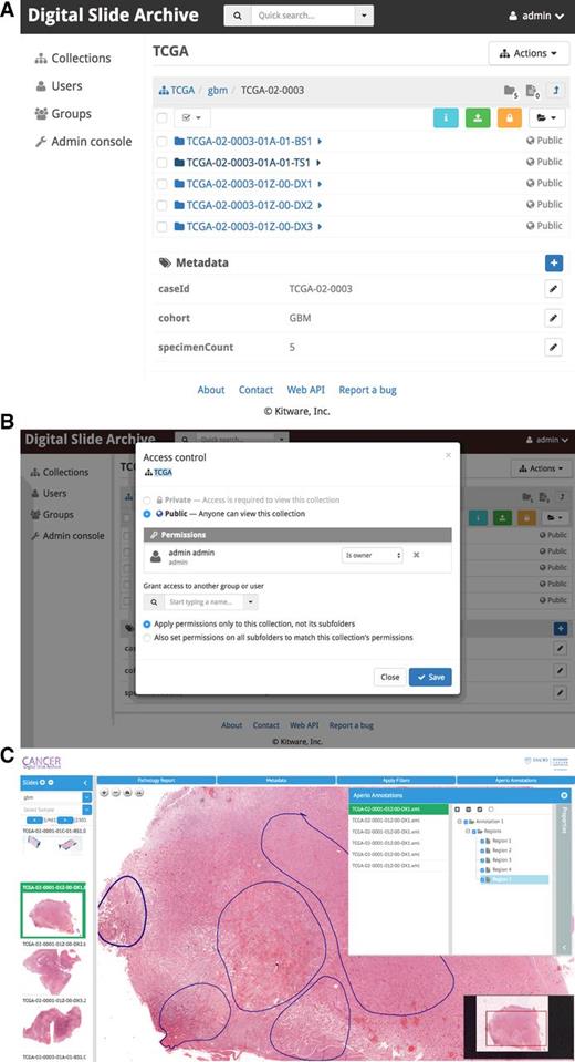 The Digital Slide Archive: A Software Platform for Management ...