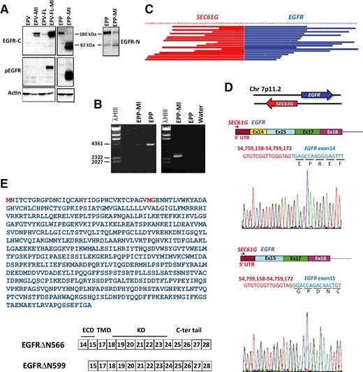 Novel SEC61G–EGFR Fusion Gene in Pediatric Ependymomas Discovered by ...