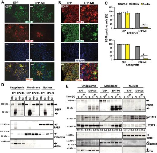 Novel SEC61G–EGFR Fusion Gene in Pediatric Ependymomas Discovered by ...