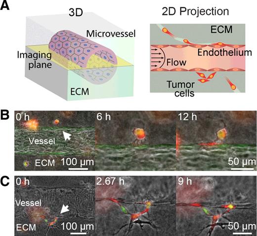 Mitosis-Mediated Intravasation in a Tissue-Engineered Tumor–Microvessel ...