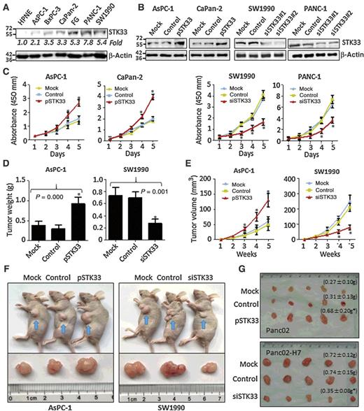 STK33 Promotes Growth and Progression of Pancreatic Cancer as a ...