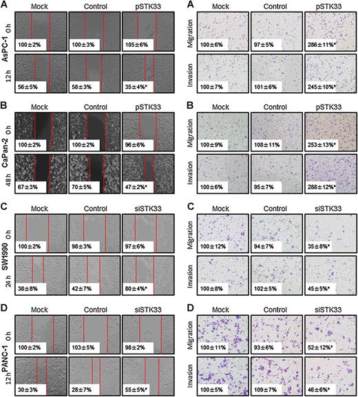 STK33 Promotes Growth and Progression of Pancreatic Cancer as a ...